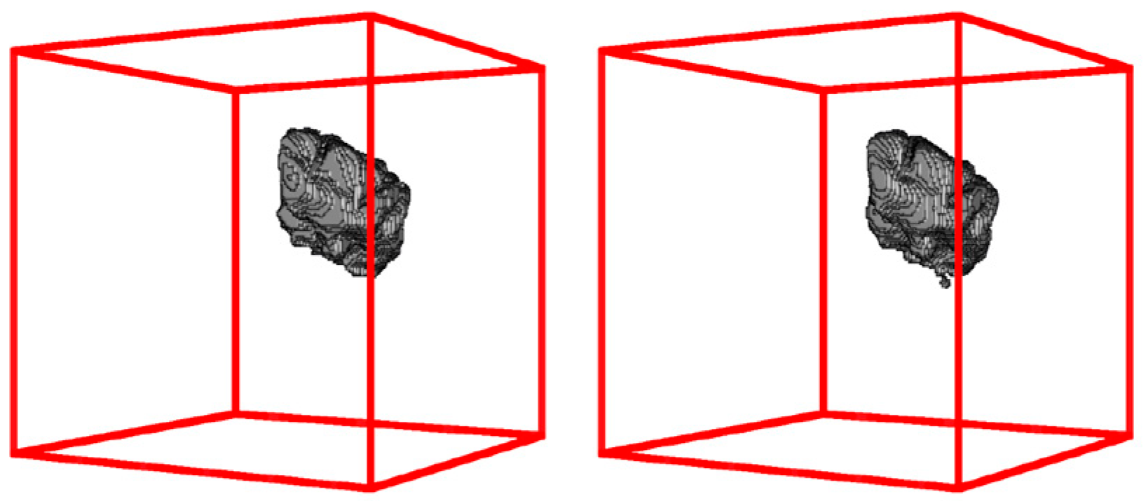 Diagnostics | Free Full-Text | Segmentation of Brain Tumor Using a 3D Generative Adversarial Network