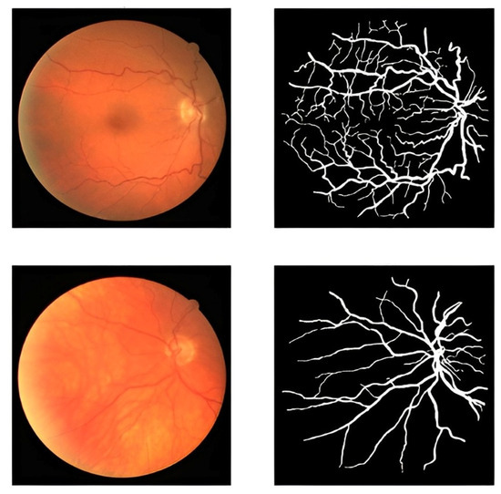 Multi-Layer Preprocessing and U-Net with Residual Attention Block for Retinal Blood Vessel ...