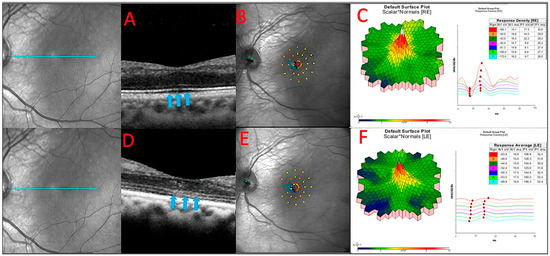 Diagnostics | Free Full-Text | Structural and Functional Changes in Non ...