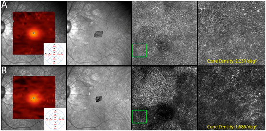 Diagnostics | Free Full-Text | Structural and Functional Changes in Non ...