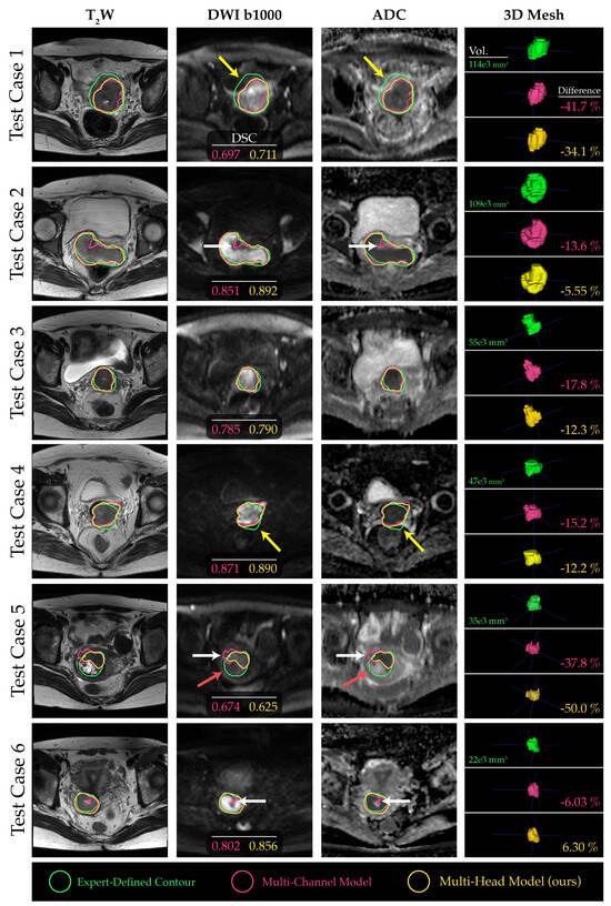 Diagnostics | Free Full-Text | Deep Learning Framework with Multi-Head Dilated Encoders for ...