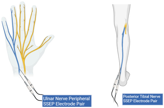 Application of Machine Learning Strategies to Model the Effects of ...