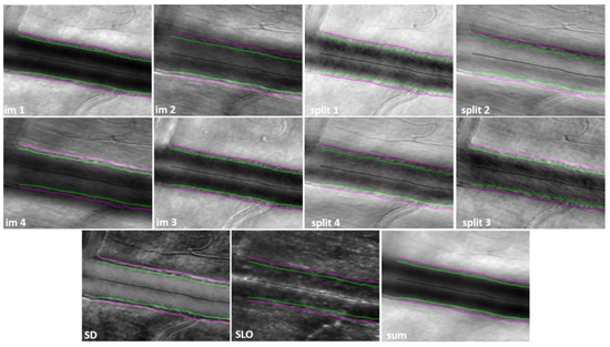 Cellular-Level Analysis of Retinal Blood Vessel Walls Based on Phase ...