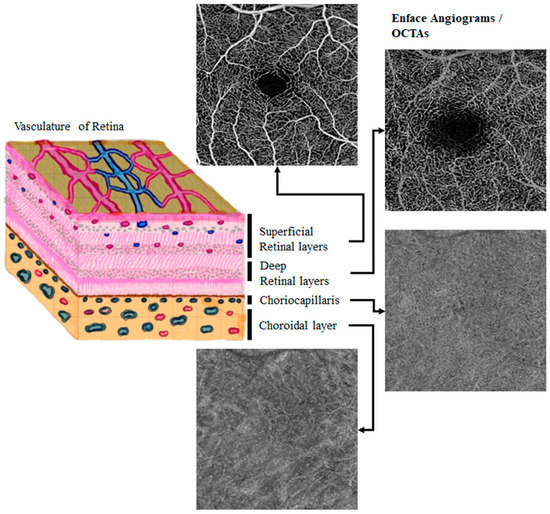 A Complete Review of Automatic Detection, Segmentation, and ...