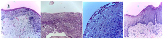 Diagnostics | Free Full-Text | A Deep Learning Framework with an Intermediate Layer Using the ...