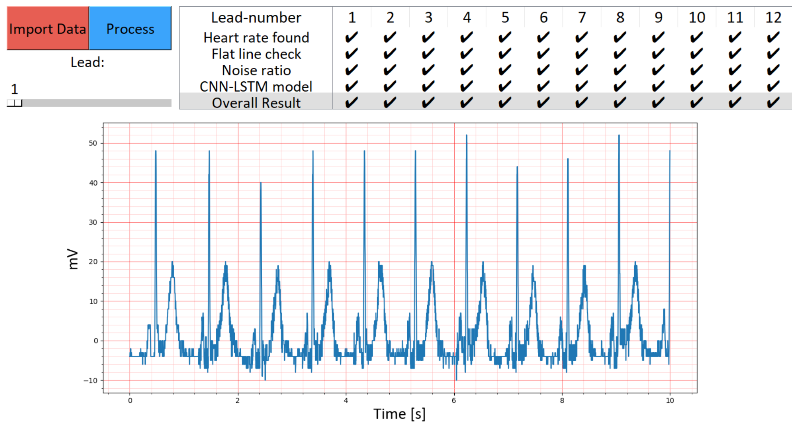 An Open-Source Graphical User Interface-Embedded Automated Electrocardiogram Quality Assessment ...