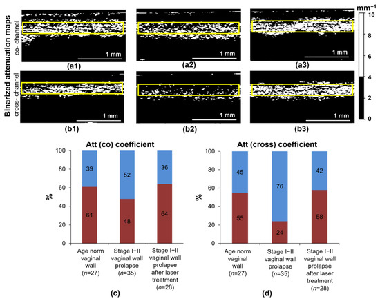 Depth-Resolved Attenuation Mapping of the Vaginal Wall under Prolapse and after Laser Treatment ...