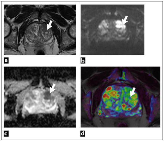 Diagnostics | Free Full-Text | Dynamic Contrast-Enhanced Study in the ...