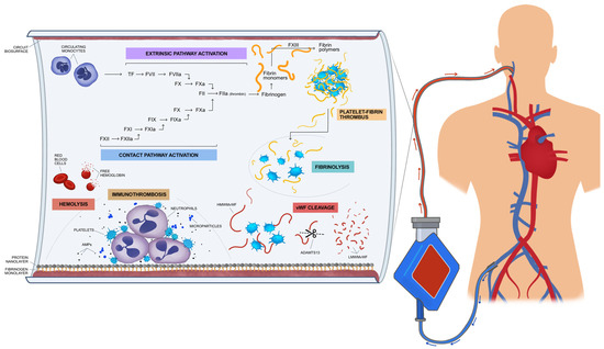 Diagnostics | Free Full-Text | Extracorporeal Membrane Oxygenation ...