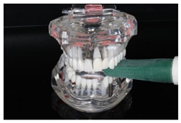 Validation of a New Measuring Instrument for the Assessment of Bite Force