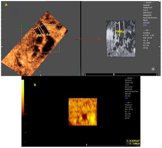Evolution of Fetal Cardiac Imaging over the Last 20 Years
