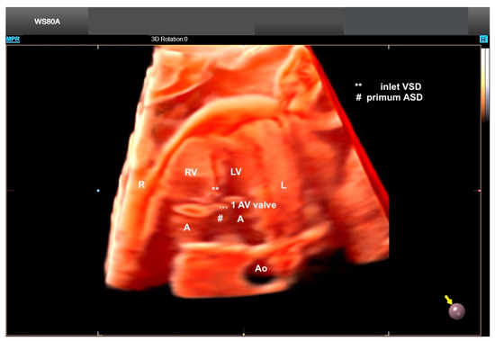 Evolution of Fetal Cardiac Imaging over the Last 20 Years