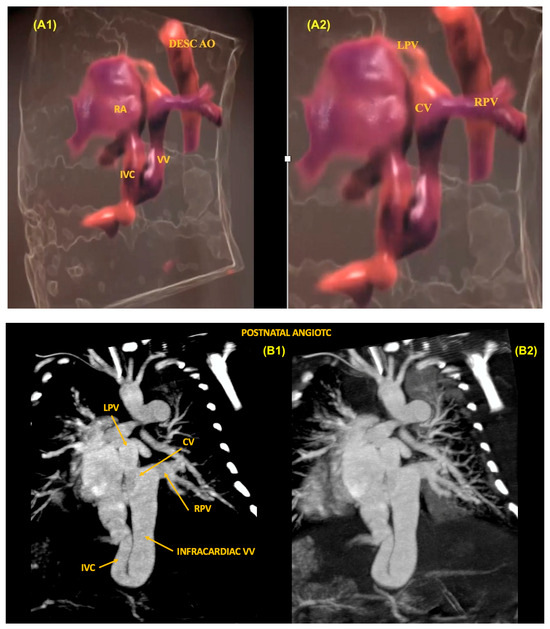 Evolution of Fetal Cardiac Imaging over the Last 20 Years