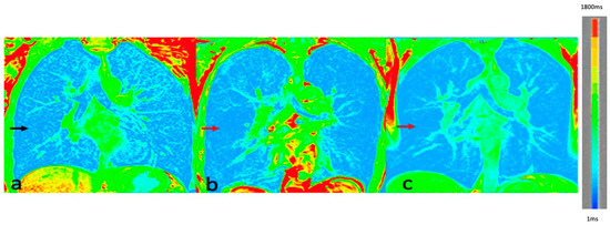 Diagnostics | Free Full-Text | Evaluation of Dynamic Contrast-Enhanced and Oxygen-Enhanced ...