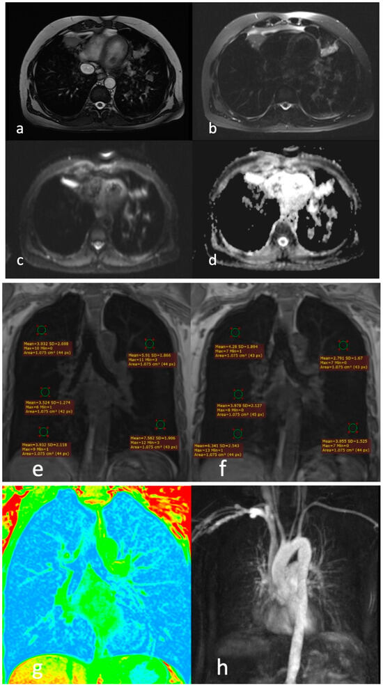 Diagnostics | Free Full-Text | Evaluation of Dynamic Contrast-Enhanced and Oxygen-Enhanced ...