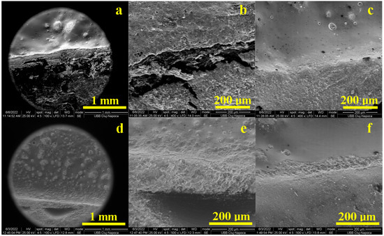 SEM Evaluation of Marginal Adaptation E-Max Crowns Manufactured by ...
