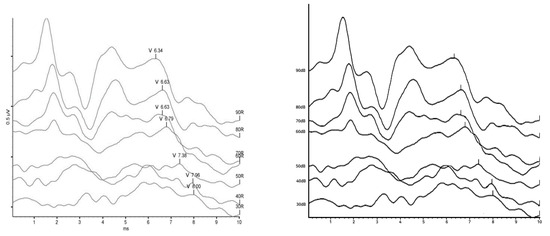Diagnostics | Free Full-Text | Auditory Brainstem Response Data Preprocessing Method for the ...