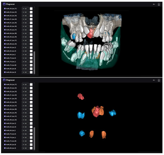 Assessing the Efficacy of AI Segmentation in Diagnostics of Nine Supernumerary Teeth in a ...
