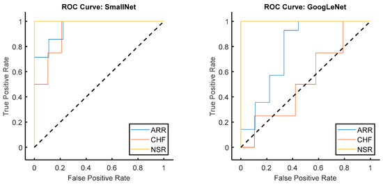 Deep-Learning-Based Arrhythmia Detection Using ECG Signals: A Comparative Study and Performance ...