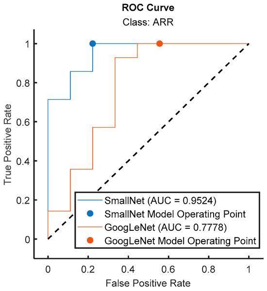 Deep-Learning-Based Arrhythmia Detection Using ECG Signals: A Comparative Study and Performance ...