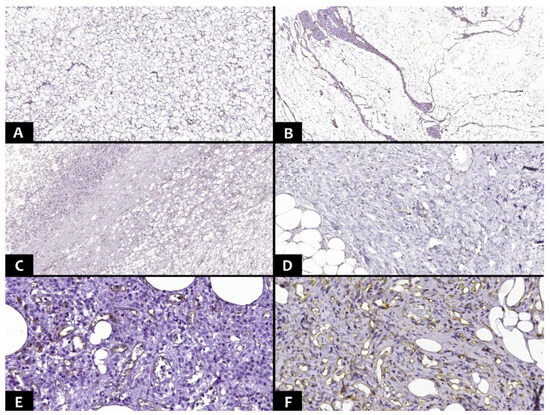 Diagnostics | Free Full-Text | The Predictive Role of the ...