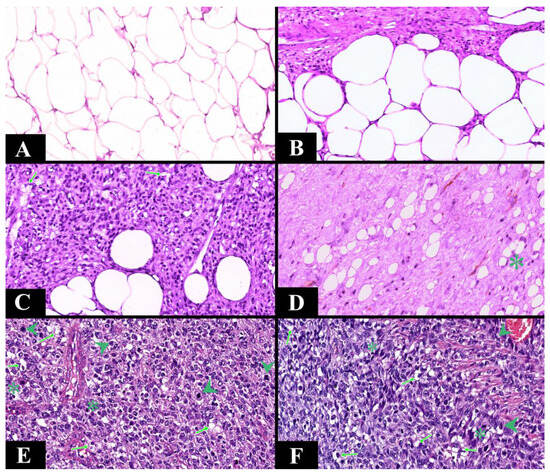 Diagnostics | Free Full-Text | The Predictive Role of the ...