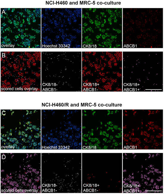 Immunofluorescence-Based Assay for High-Throughput Analysis of Multidrug Resistance Markers in ...