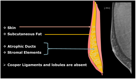 Male Breast: A Review of the Literature and Current State of the Art of ...