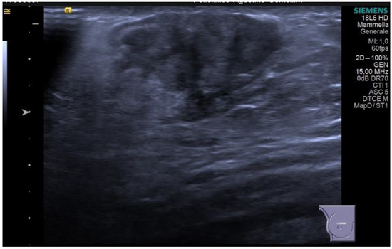 Male Breast: A Review of the Literature and Current State of the Art of ...