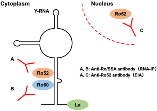 Dissociating Autoantibody Responses against Ro52 Antigen in Patients with Anti-Synthetase or ...