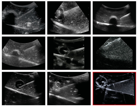 Diagnostics Free Full Text Prospective Comparison Of Handheld