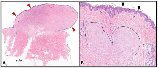 From Histopathology to High-Resolution Ultrasound Imaging of Skin Scars