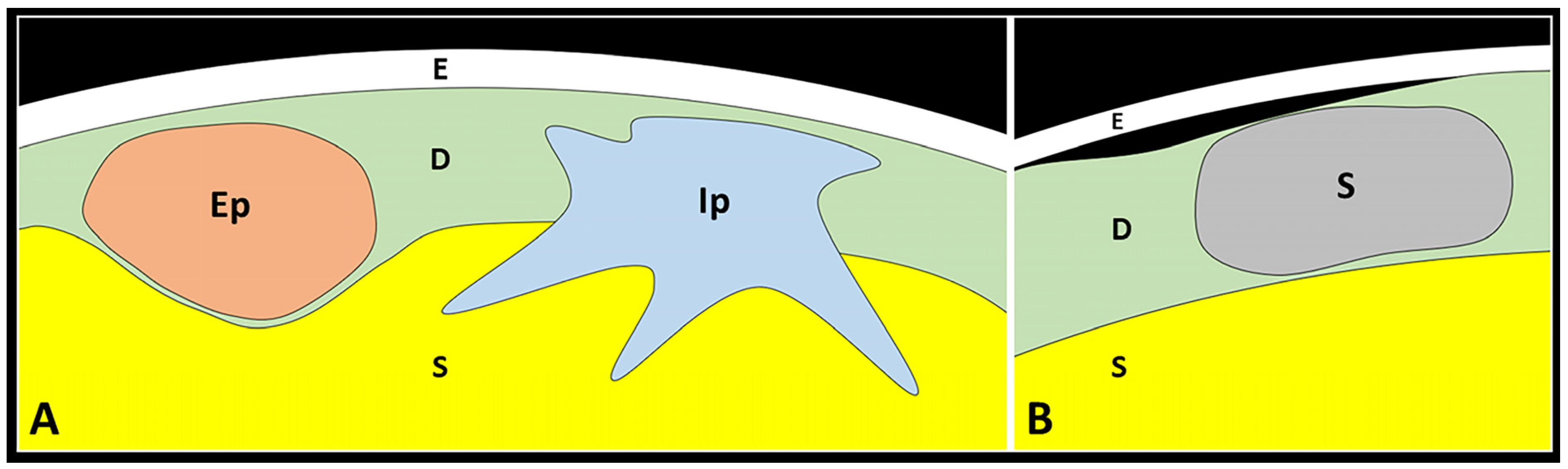 From Histopathology to High-Resolution Ultrasound Imaging of Skin Scars