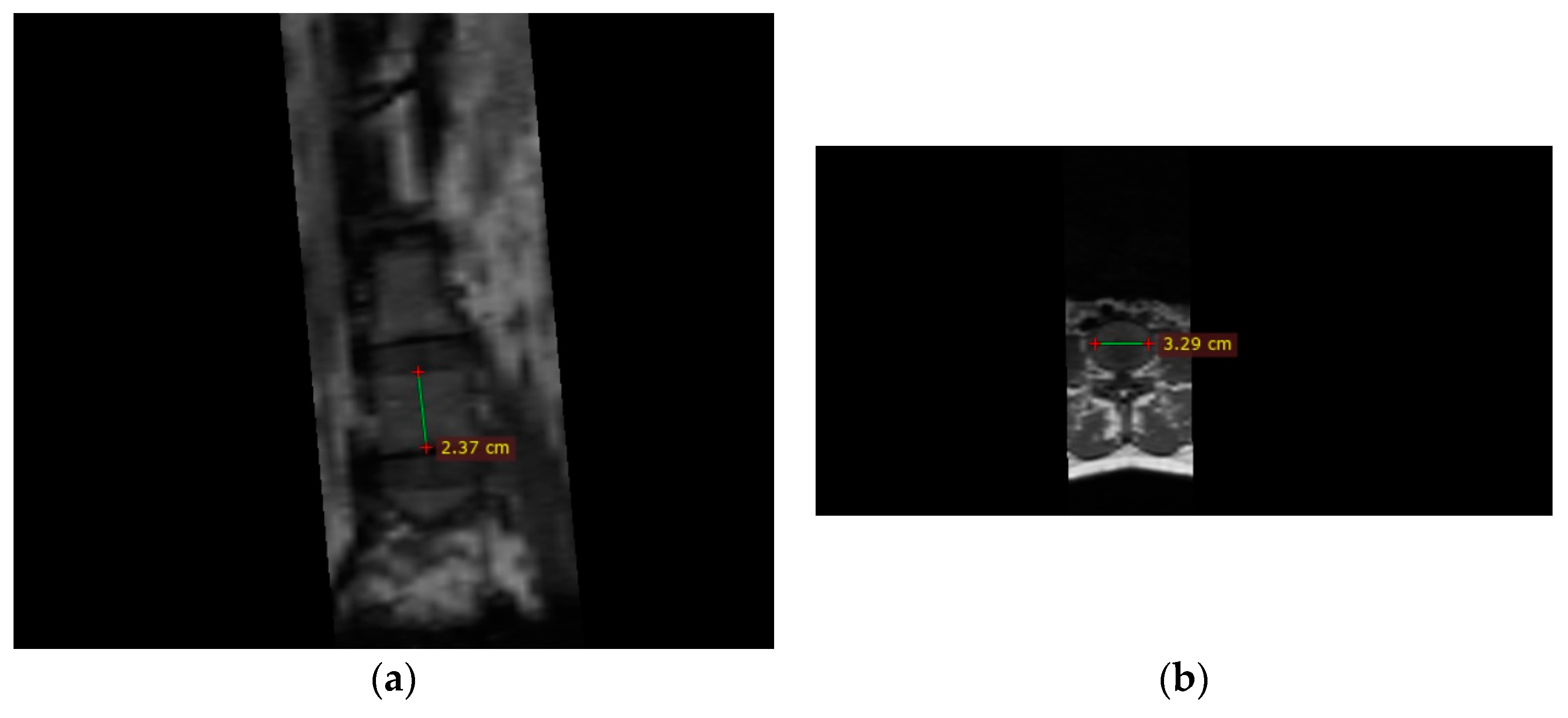 Diagnostics Free Full Text Machine Learning Models For Prediction