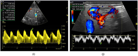 Diagnostics | Free Full-Text | Review on Pediatric Malignant Focal ...