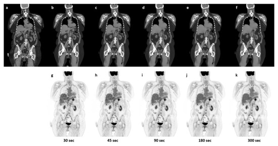 Attenuation Correction of Long Axial Field-of-View Positron Emission ...