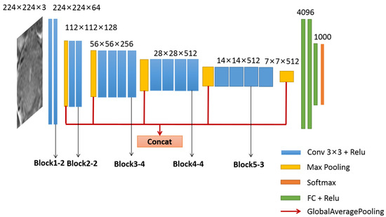 Automated Prediction of Neoadjuvant Chemoradiotherapy Response in ...
