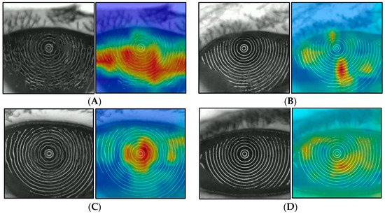 Dry Eye Subtype Classification Using Videokeratography and Deep Learning
