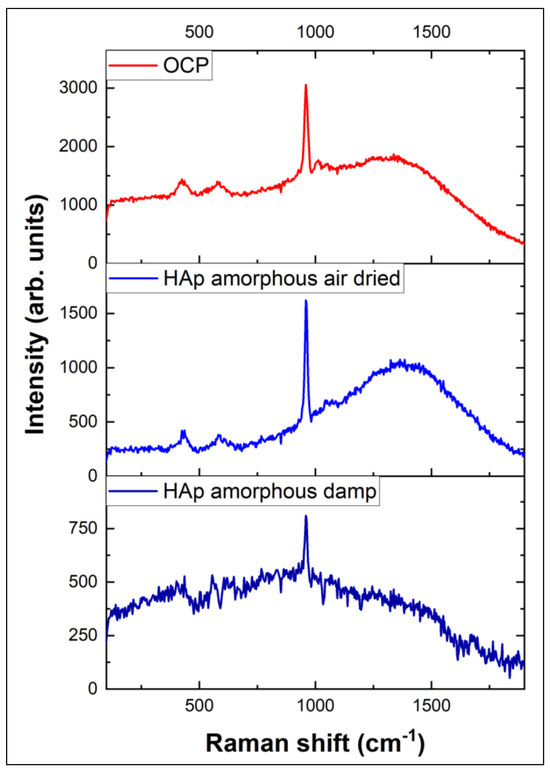 Periodontal Disease Monitoring by Raman Spectroscopy of Phosphates: New ...
