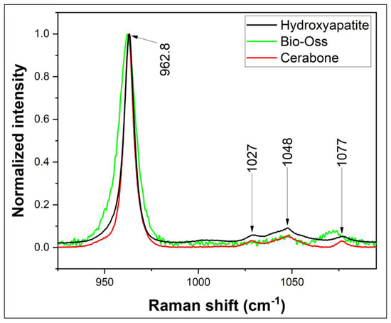Periodontal Disease Monitoring by Raman Spectroscopy of Phosphates: New ...