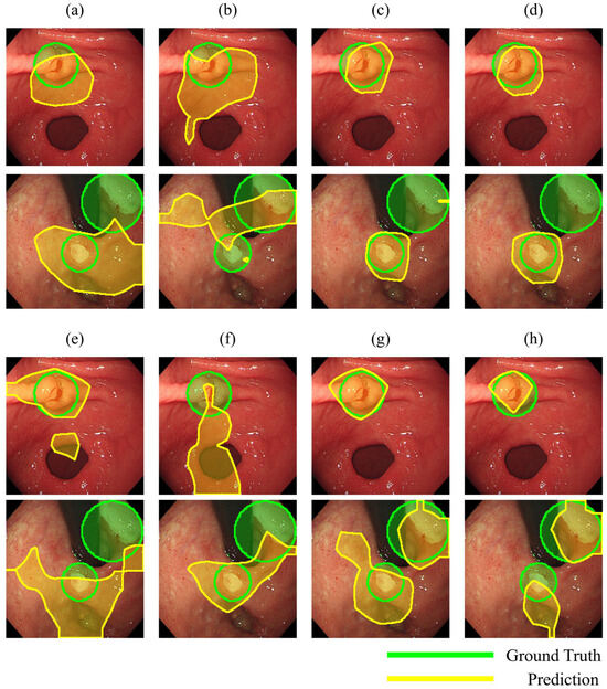 Gastro-BaseNet: A Specialized Pre-Trained Model for Enhanced ...