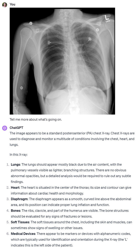 Diagnostics | Free Full-Text | Validation of a Deep Learning Chest X-ray Interpretation Model ...