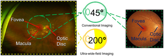 Retinal Disease Diagnosis Using Deep Learning on Ultra-Wide-Field ...