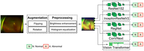 Retinal Disease Diagnosis Using Deep Learning on Ultra-Wide-Field ...