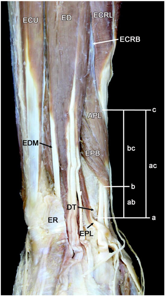 Diagnostics | Free Full-Text | Examining the Forearm Intersection ...