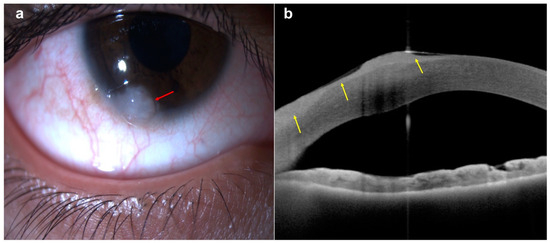 Diagnostics | Free Full-Text | Clinical Applications of Anterior ...
