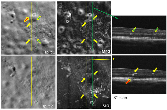Motion Contrast, Phase Gradient, and Simultaneous OCT Images Assist in ...