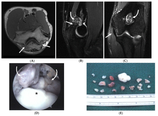 Differences in Anatomic Adaptation and Injury Patterns Related to ...