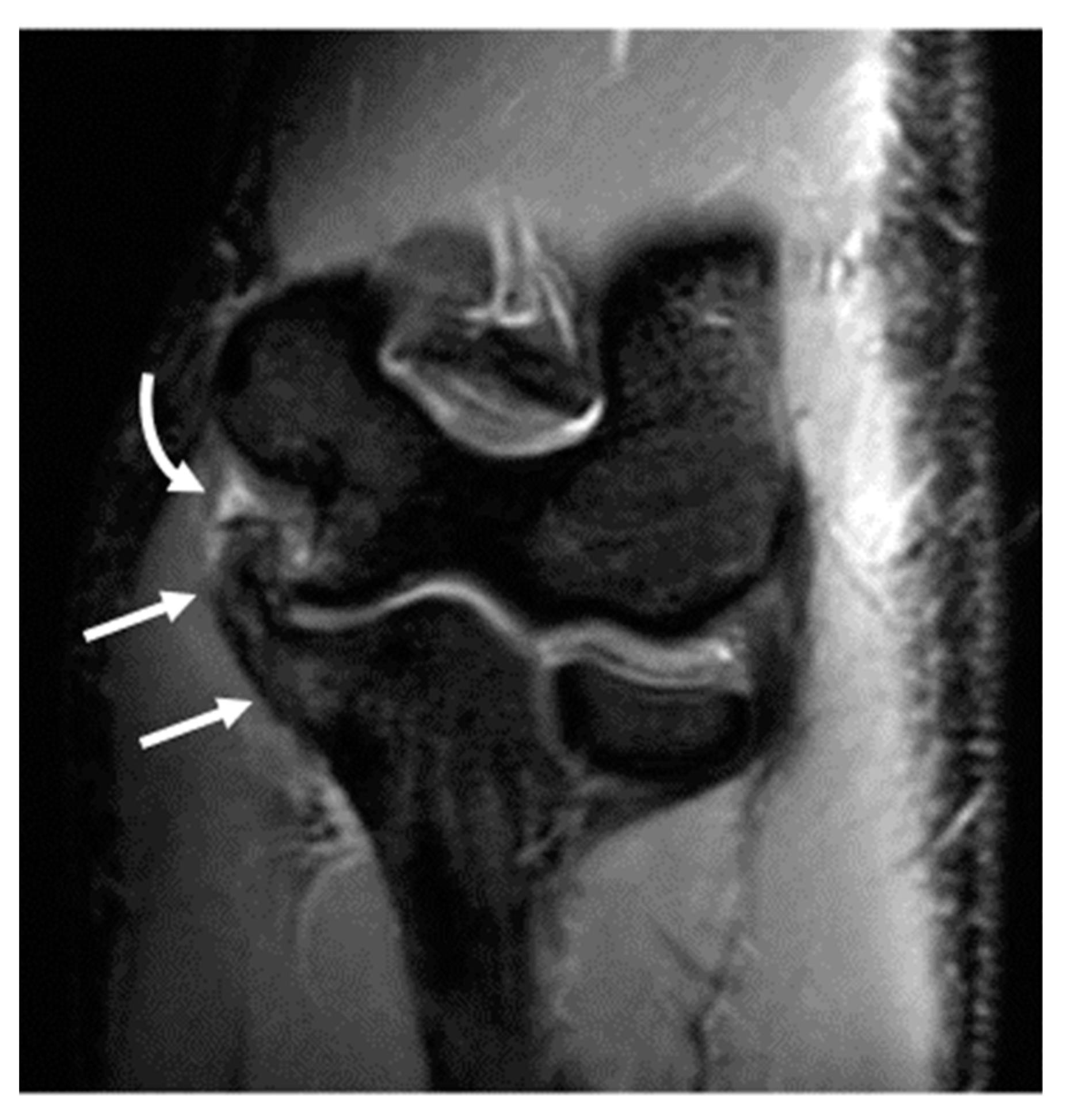 Differences in Anatomic Adaptation and Injury Patterns Related to ...