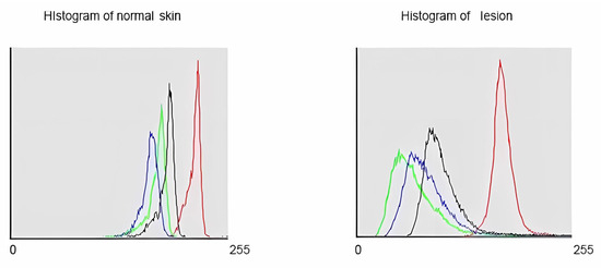 Color Analysis of Merkel Cell Carcinoma: A Comparative Study with ...